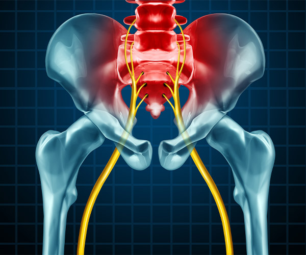 Sciatica Treatment Sydney | Massey Family Chiropractic